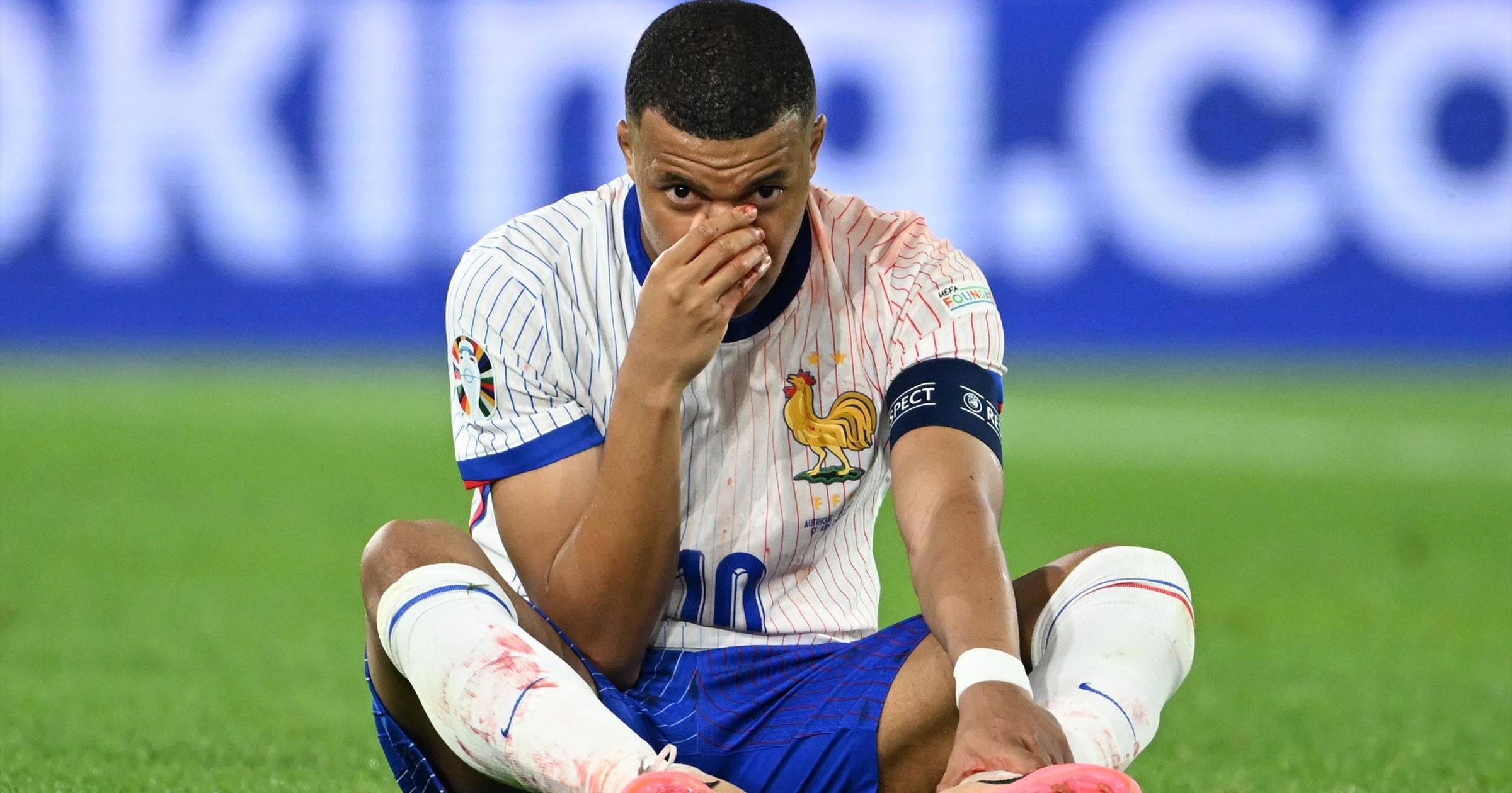 Austria 0-1 France: Bloodied Kylian Mbappe comes off with busted nose ...