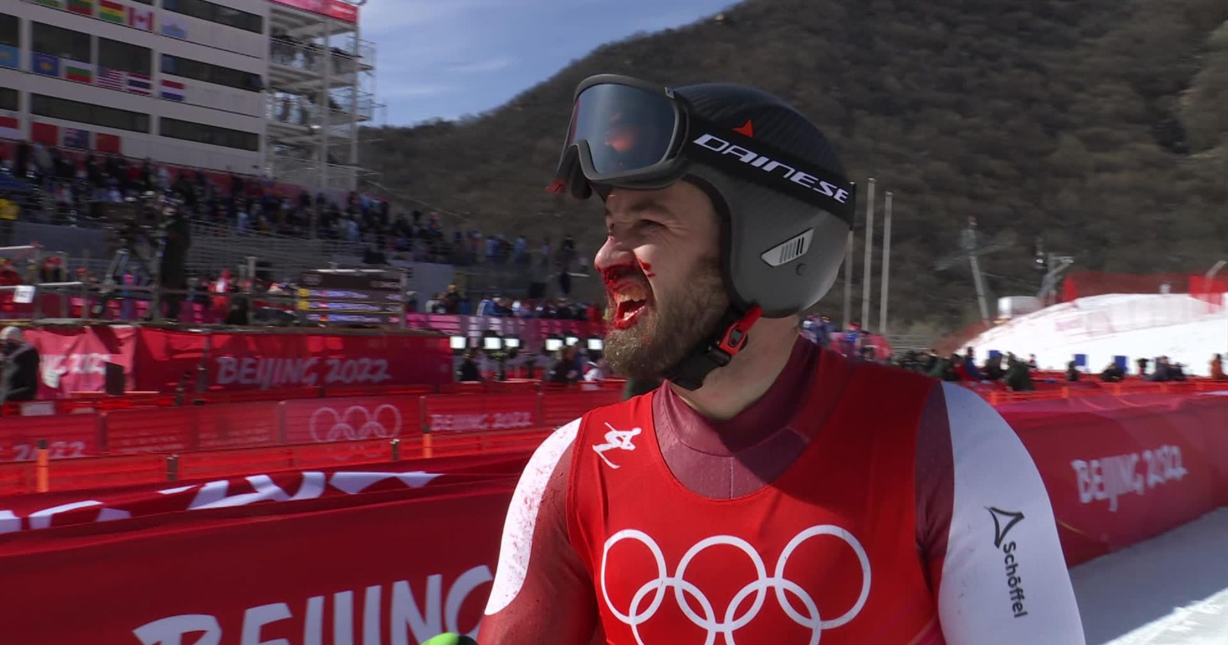 'Olympic commitment!' - Daniel Hemetsberger left with bloodied face ...