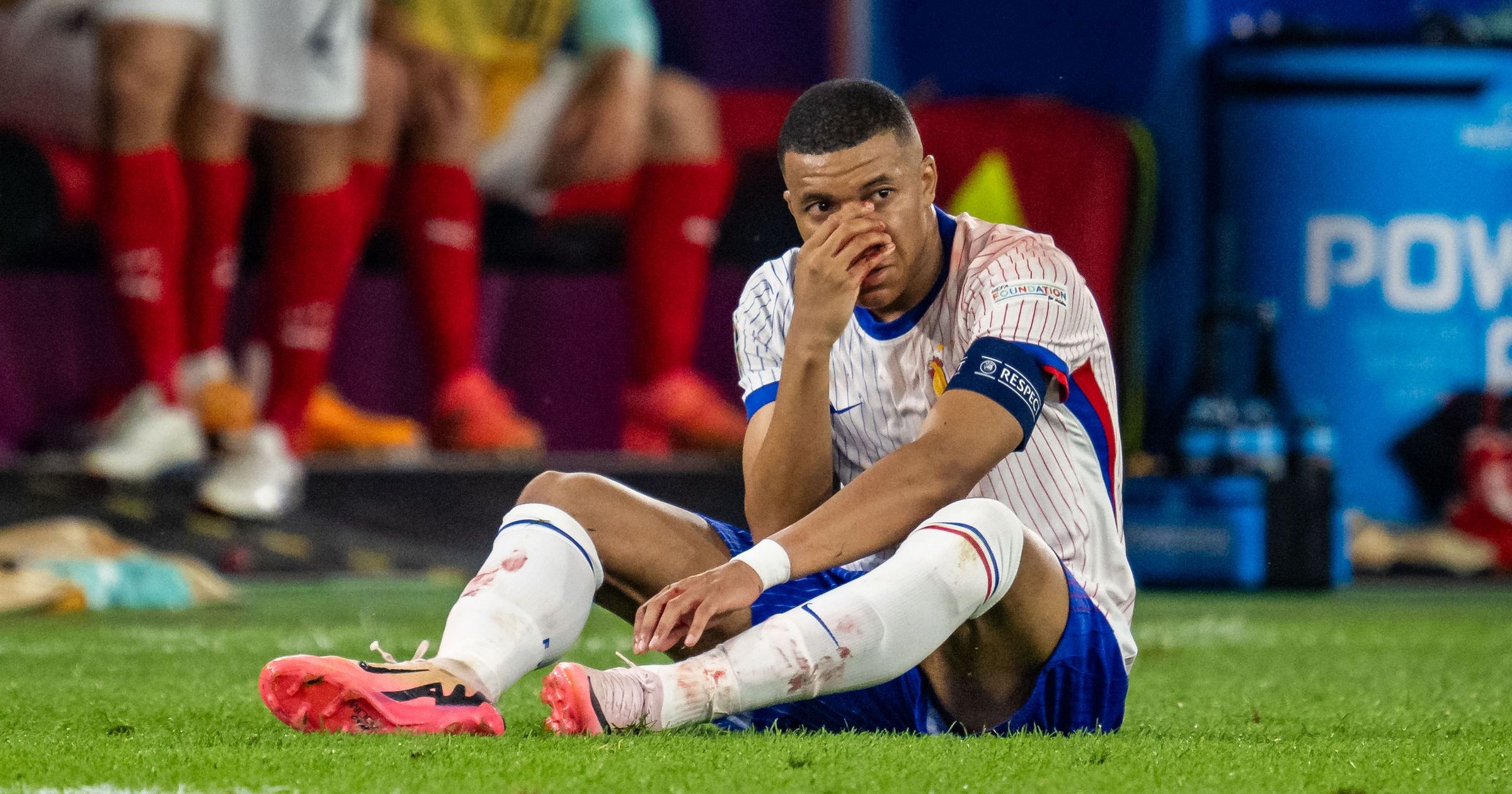 Kylian Mbappe forced off with broken nose, then earns bizarre yellow ...