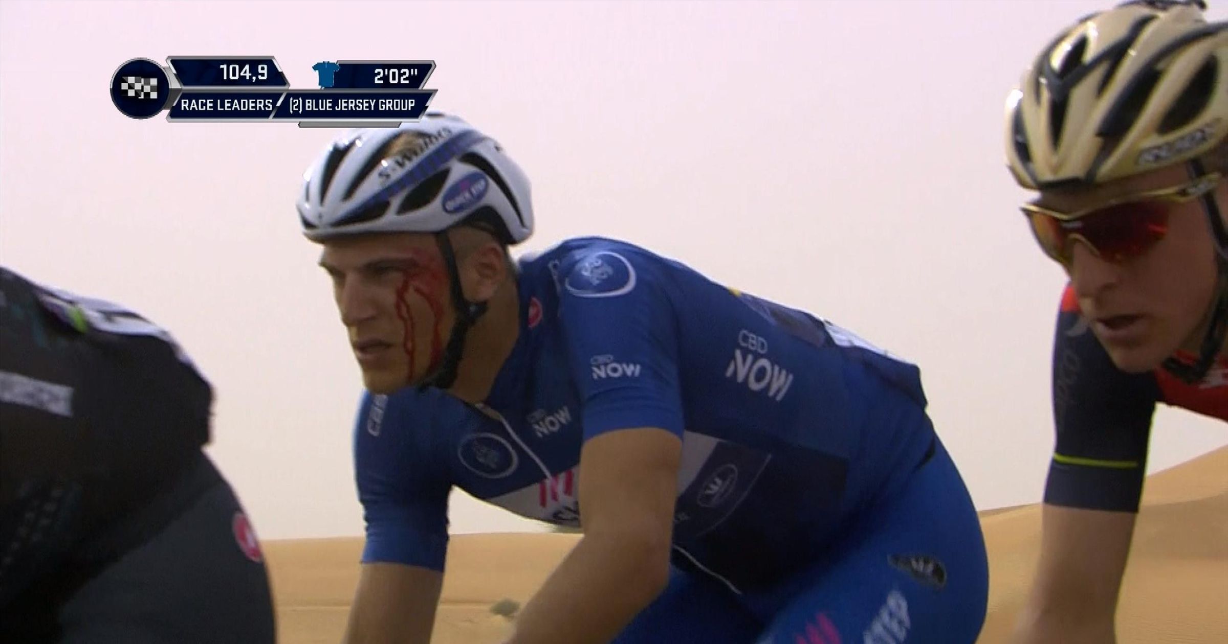 Kittel left with blood pouring from face after alleged punch - Cycling ...