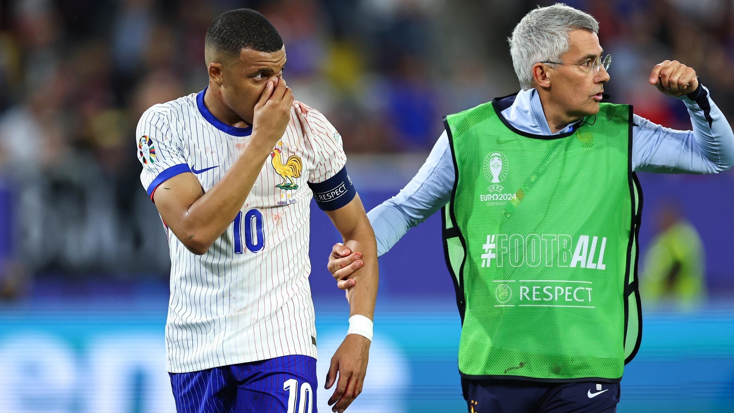 Kylian Mbappe 'better' since Euro 2024 broken nose incident, says ...