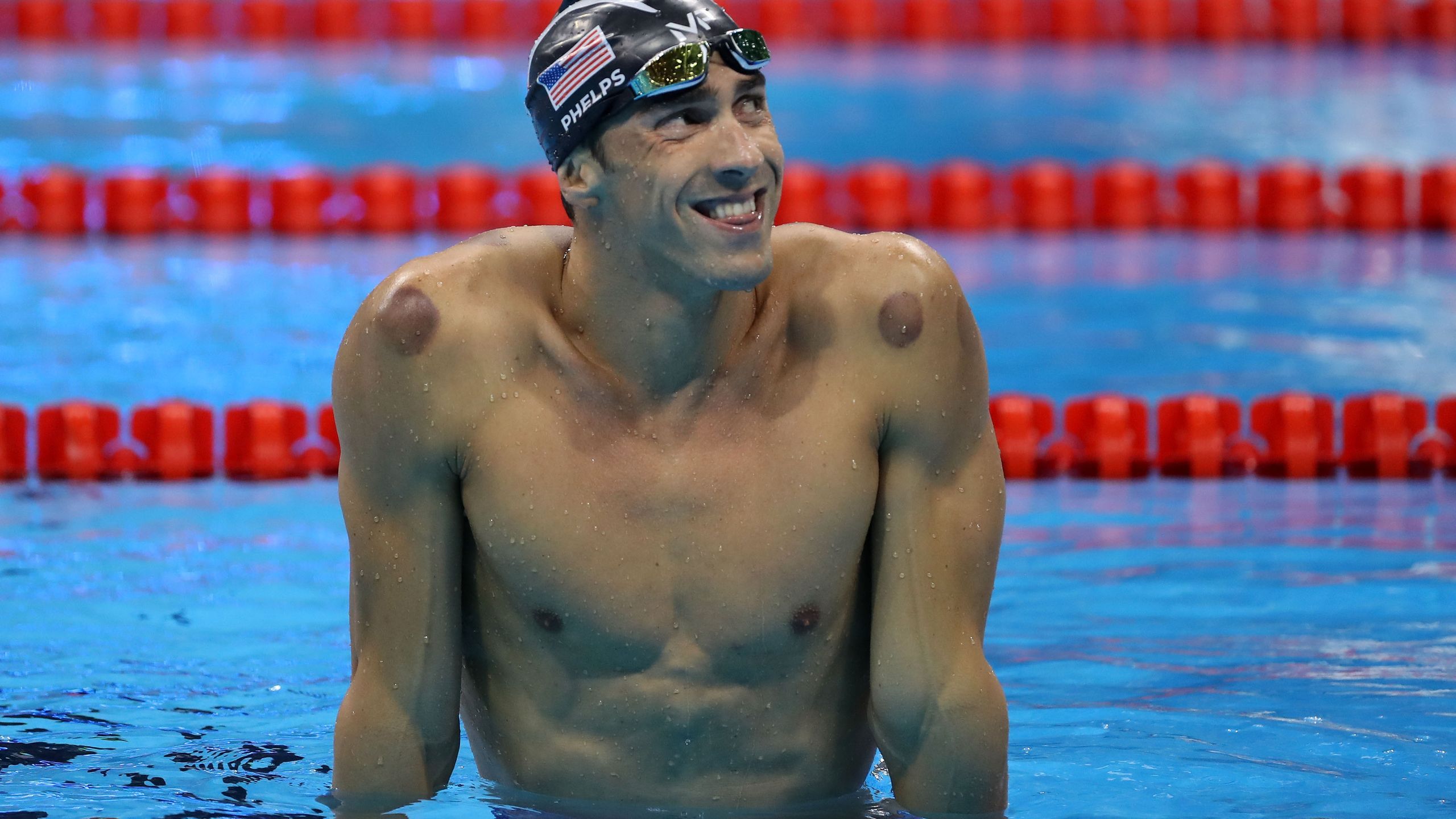 Paris Olympic Games: Why do some swimmers have dark circles on their ...