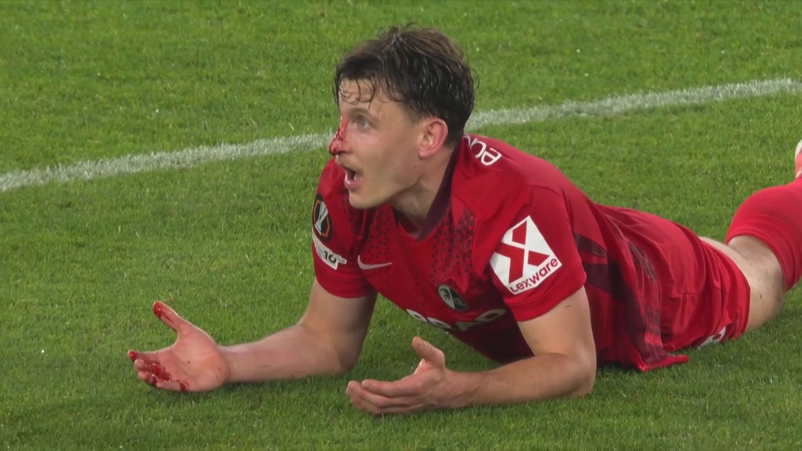 Blood pours from SC Freiburg's Maximilian Eggestein after Petar Ratkov ...