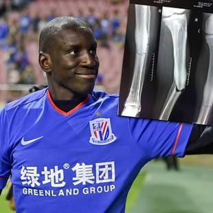 Demba Ba's horrific injury: X-rays of leg break hit social media - TNT ...