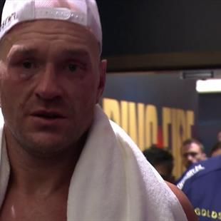 Tyson Fury makes his way back to his dressing room after losing to ...